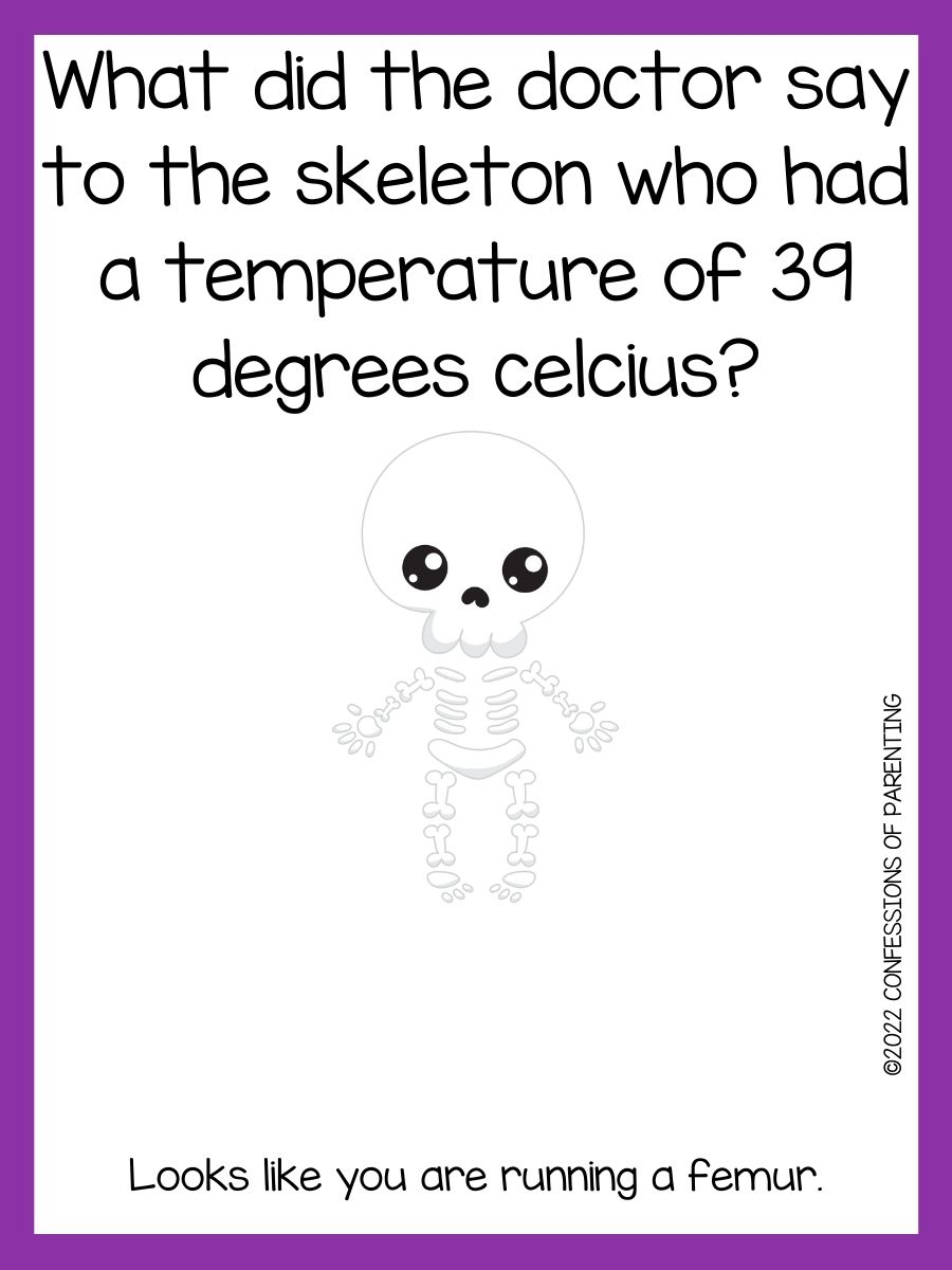 Skeleton Jokes to Make Your Bones Laugh!
