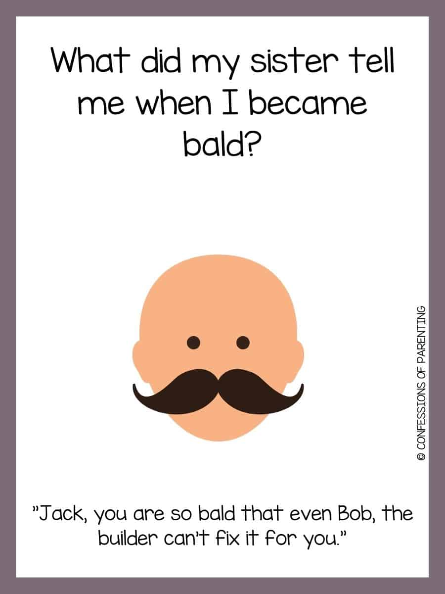 100 Best Bald Jokes