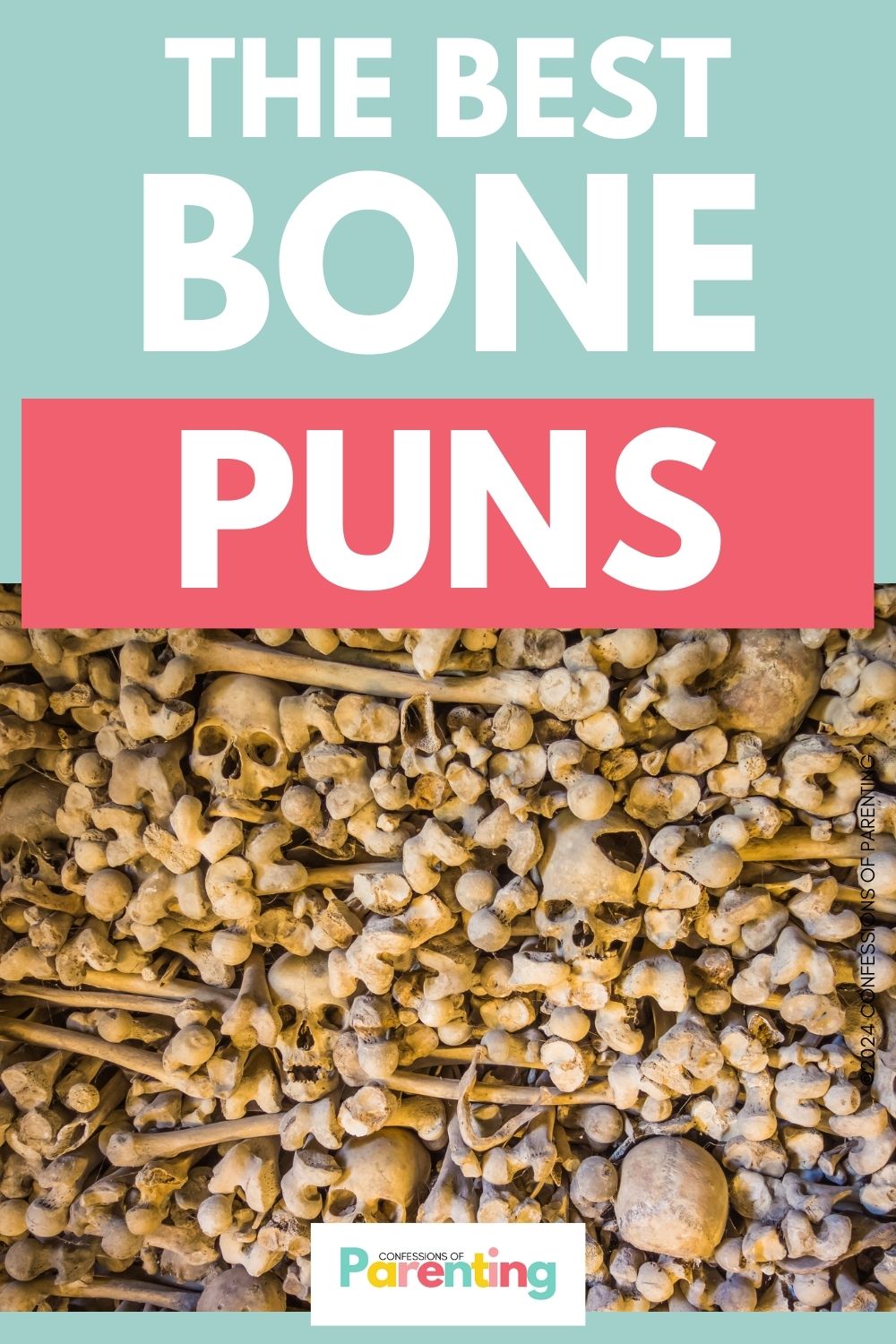 50 Best Bone Puns [Free Joke Cards]