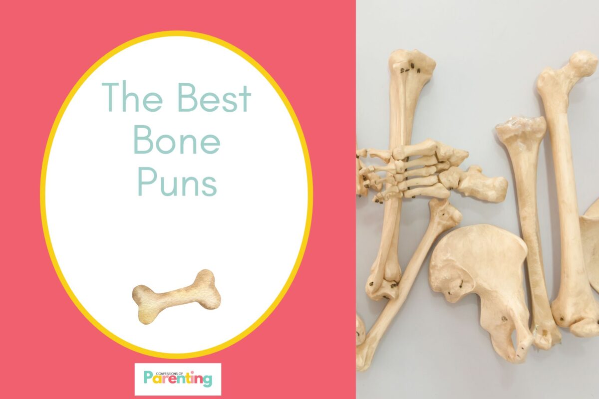 50 Best Bone Puns [Free Joke Cards]
